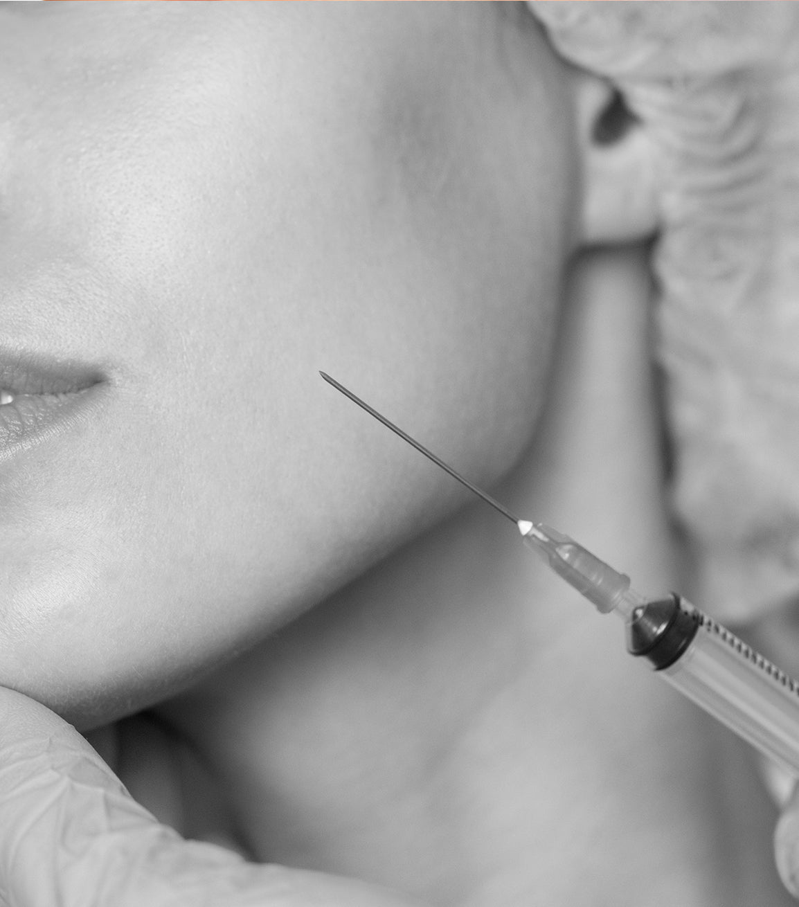 Skin Needling | Aesthetic Beauty Supplies