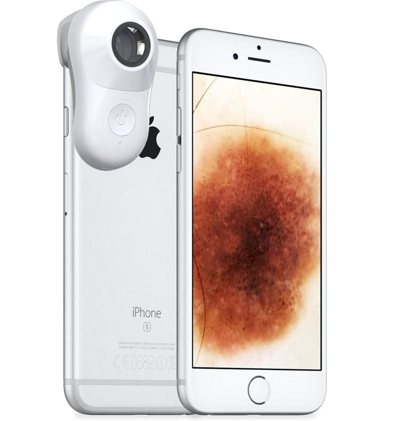 MoleScope | Aesthetic Beauty Supplies